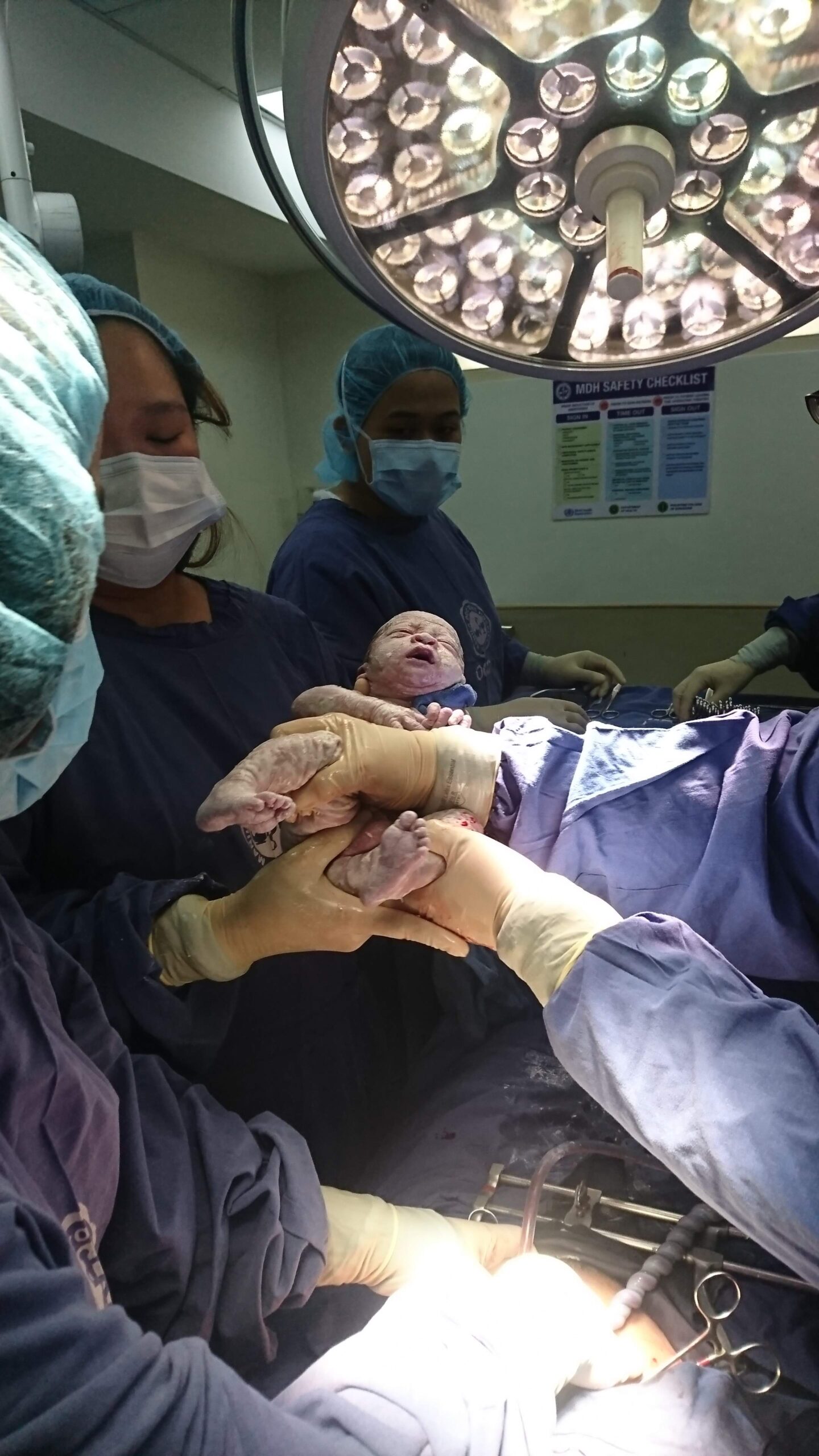 Caesarian is nothing! | MommyBelleph.com